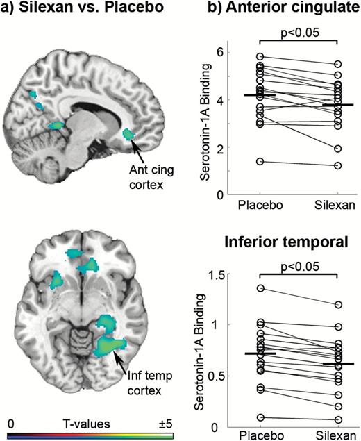 Aromaterapia: Effects of Silexan on the Serotonin-1A Receptor – CABSIN